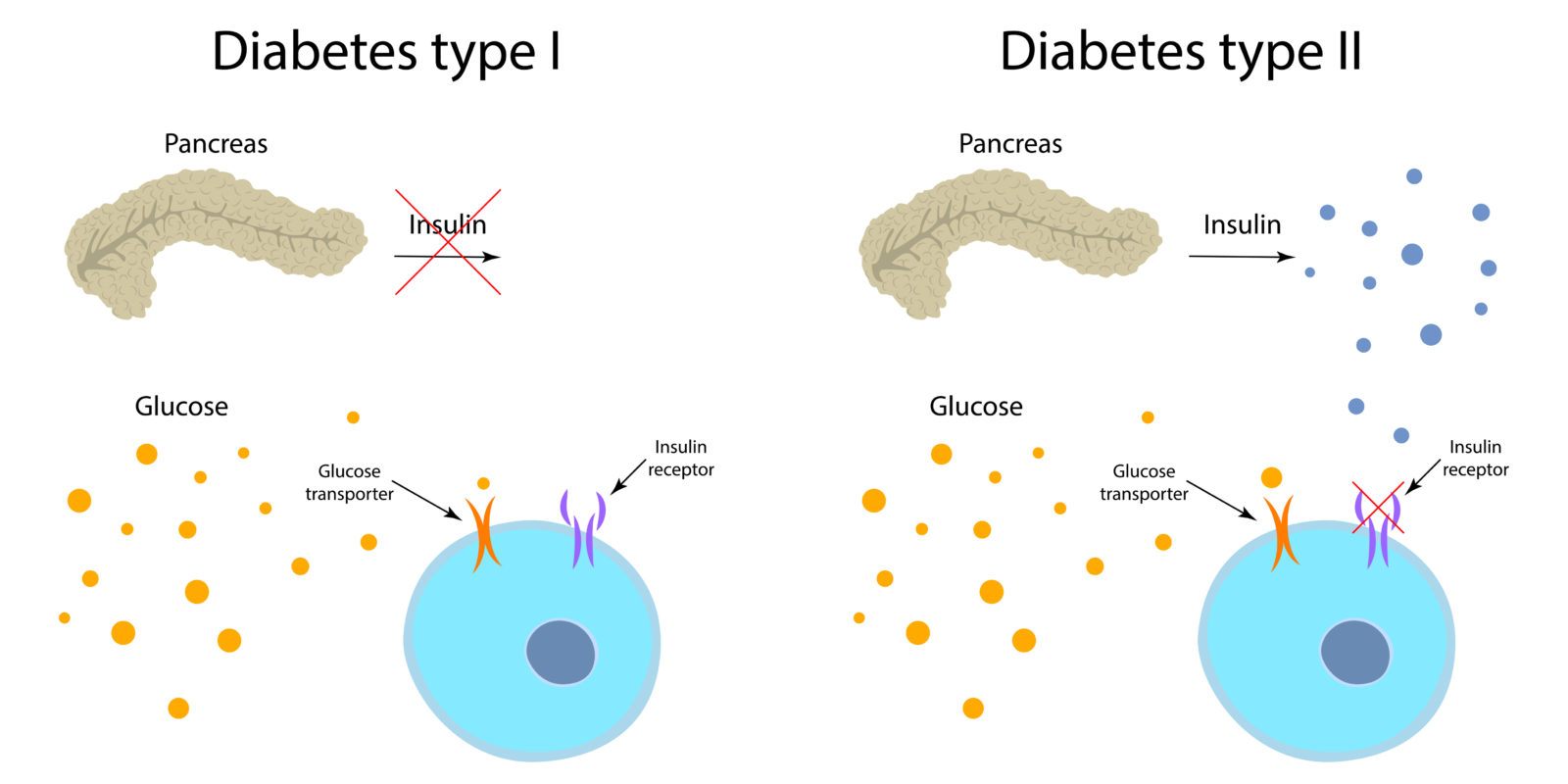 2023 Life Insurance with Type 1 and Type 2 Diabetes - PinnacleQuote